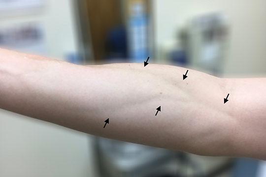 The groove sign - American Osteopathic Association