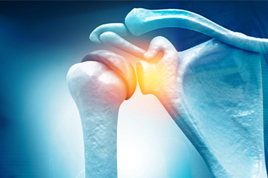 Rotator cuff injuries: improving identification with bedside ultrasound ...